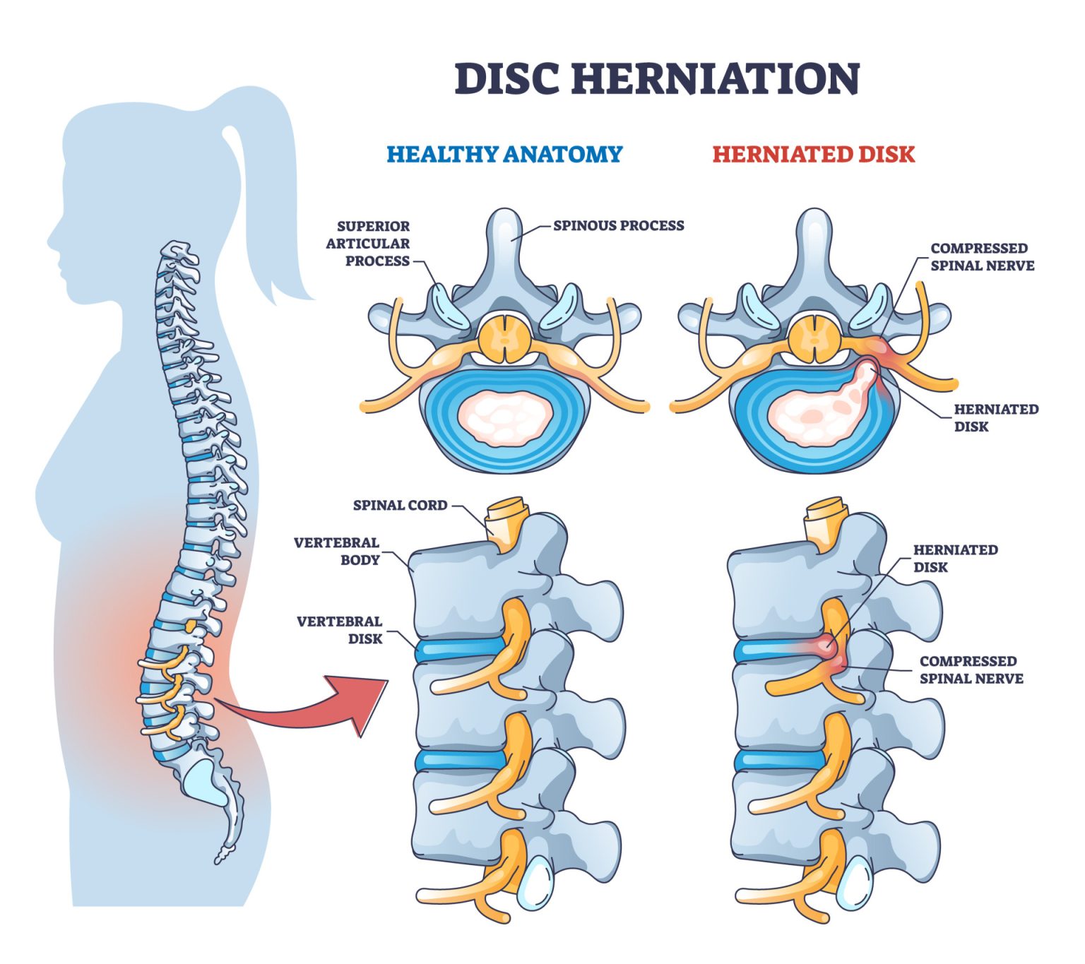 Spinal Nerves – What They Are and What They Do