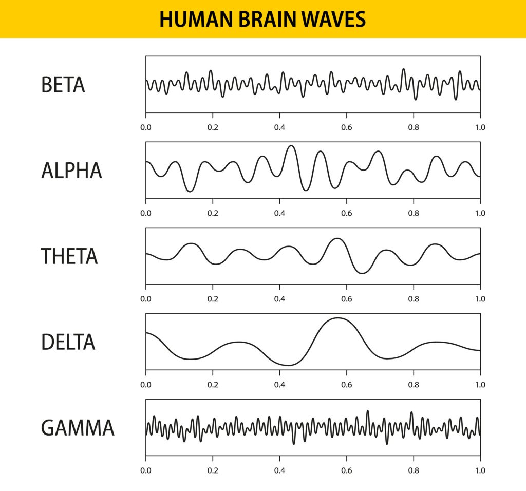EEG Procedure EEG Procedure